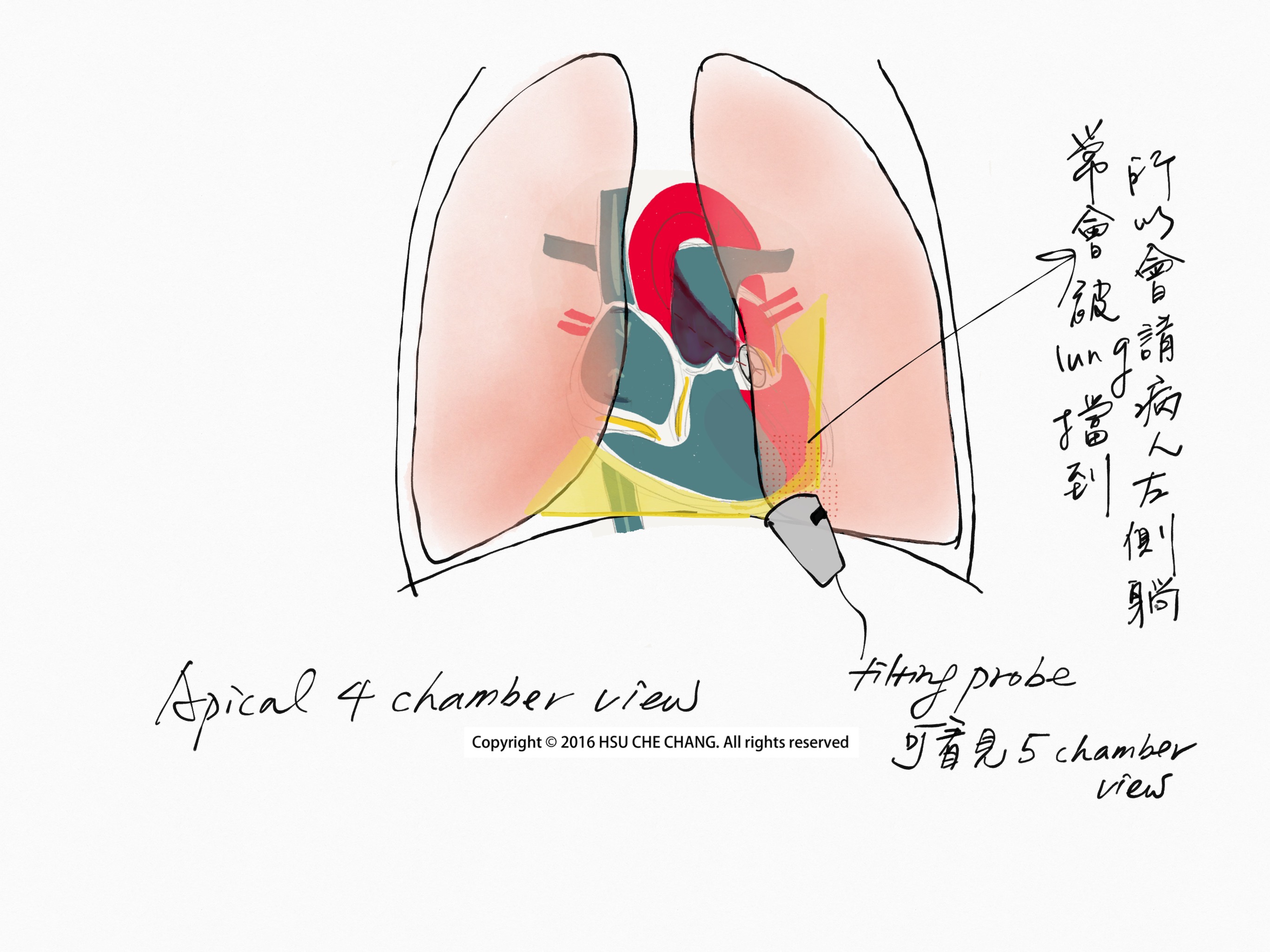 image – POCUS Academy