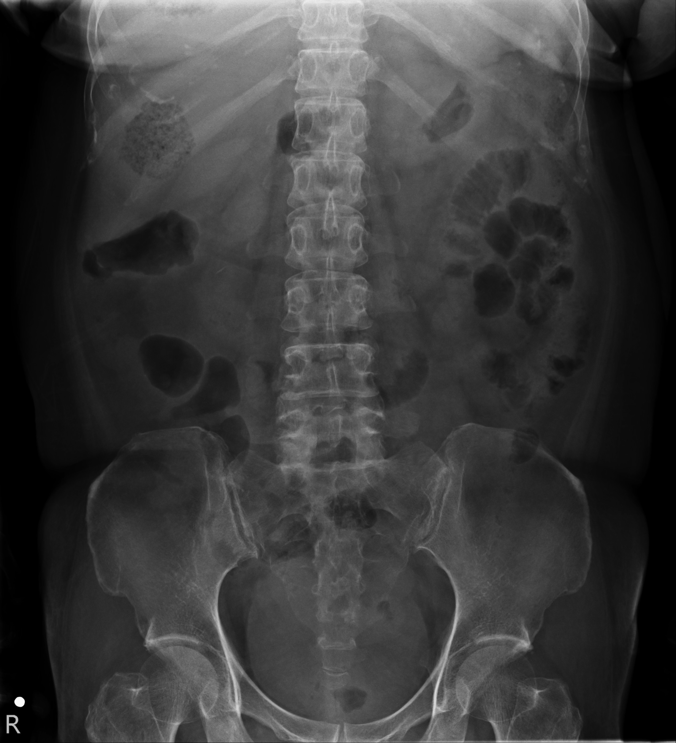 KUB-1 – POCUS Academy