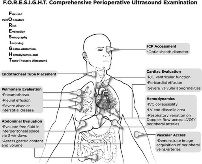 FORESIGHT: Whole Body POCUS – POCUS Academy