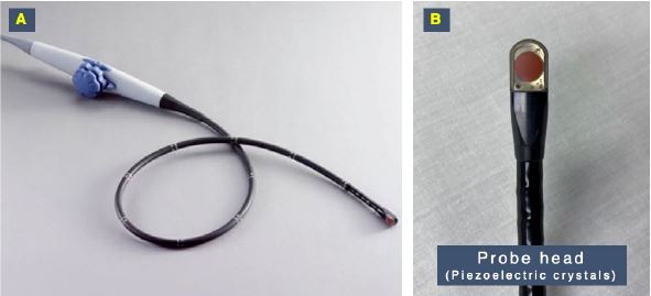 How to Perform Resuscitative TEE in ED (from ACEP Now) – POCUS Academy
