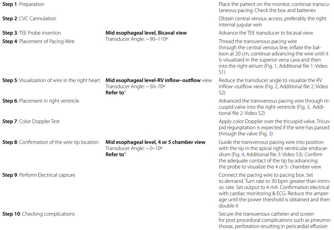 TEE-guided TVP in ER – POCUS Academy