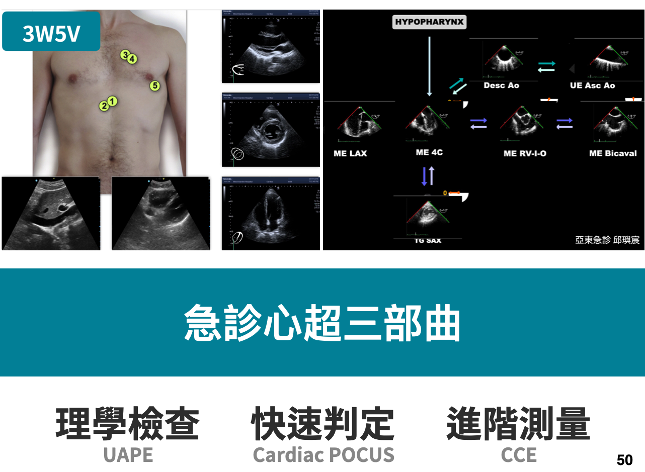 雙和急診超音波教學-TTE vs TEE – POCUS Academy