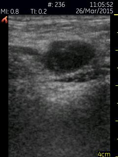 POCUS cases (Vscan) – POCUS Academy