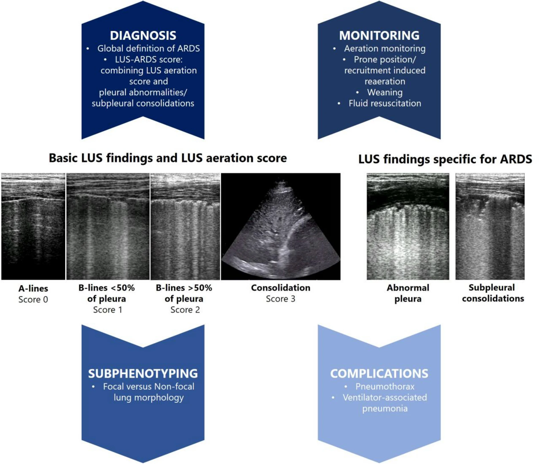 Lung ultrasound for diagnosis and management of ARDS (ICM) – POCUS Academy