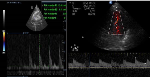How I use ultrasound in cardiac arrest (ICM) – POCUS Academy